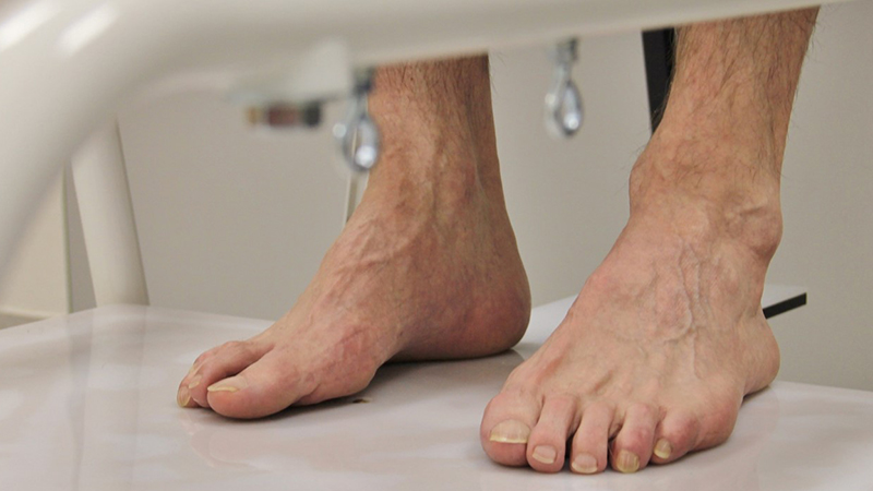 Die sensible Fußsohle im Fokus | TUCaktuell | TU Chemnitz